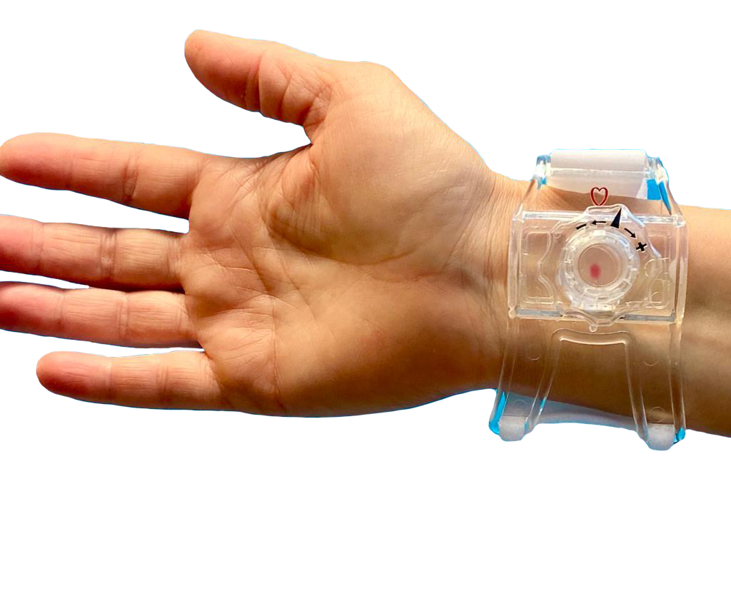 Radial Optimal Compression