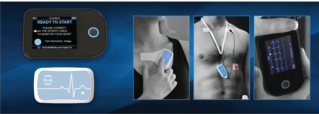 Complete Data Management For Cardiac Implantable Device Monitoring